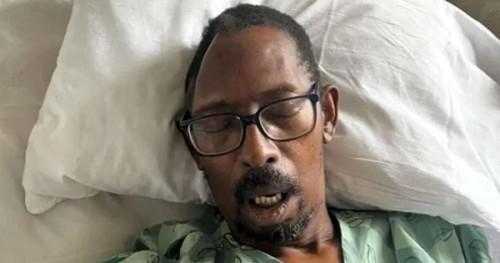 Black Man Sues Hospital in Atlanta For Allegedly Losing Part of His Skull