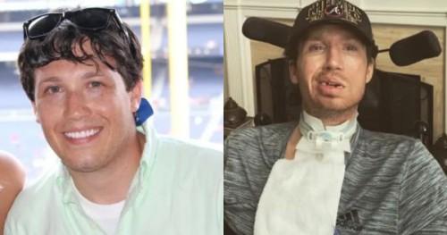 Georgia Man Awarded $75M After a Routine Chiropractor Visit Left Him Permanently Paralyzed