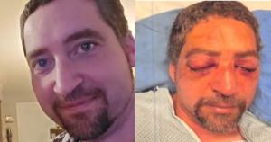 Vermont Man May Lose Both Eyes After Random Road Rage Attack